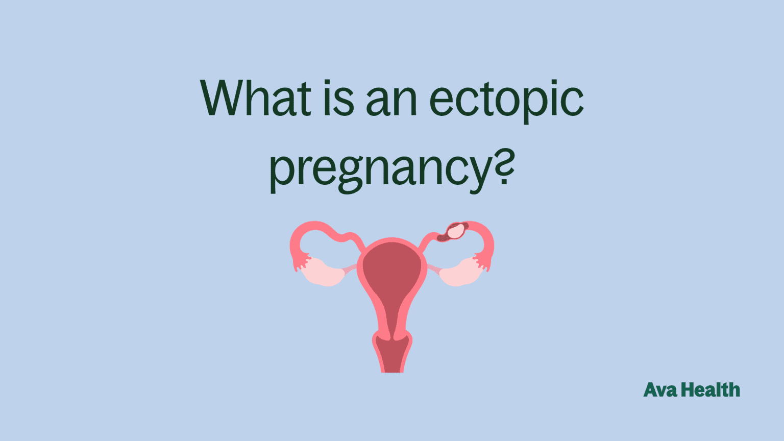 What Is an Ectopic Pregnancy? | Ava Health